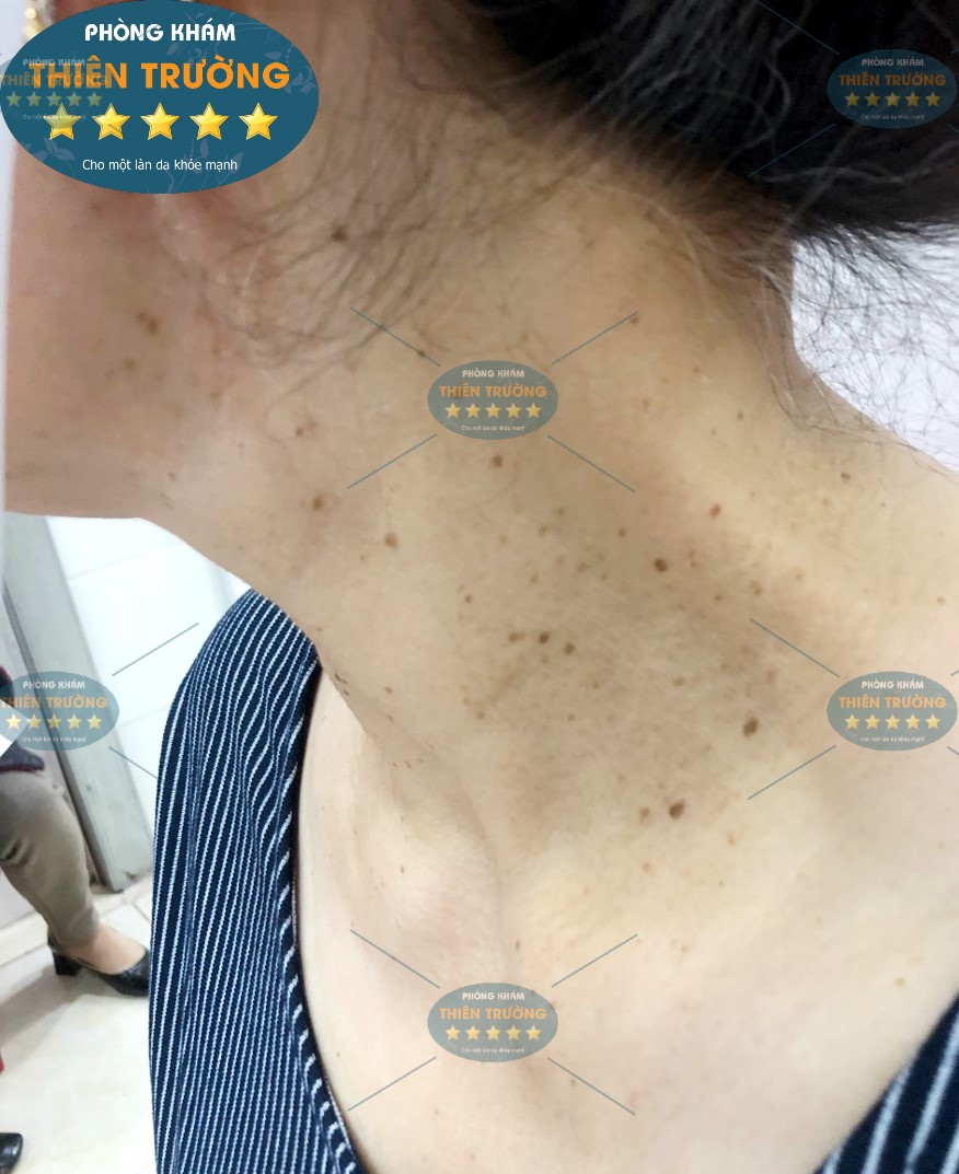 Top 5 Phòng Khám Hỗ Trợ Điều Trị U Mềm Treo An Toàn Tại Nam Định - Da ...